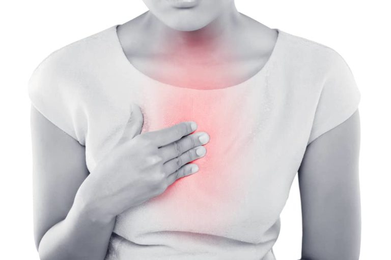 Is Heartburn a Sign of Gastric Cancer | Saint John's Cancer Institute