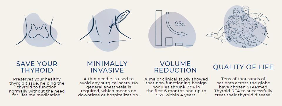 Thyroid Radiofrequency Ablation | Saint John’s Cancer Institute