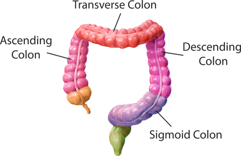 About Colorectal Cancer: Symptoms, Risk Factors, Diagnosis & Stages ...