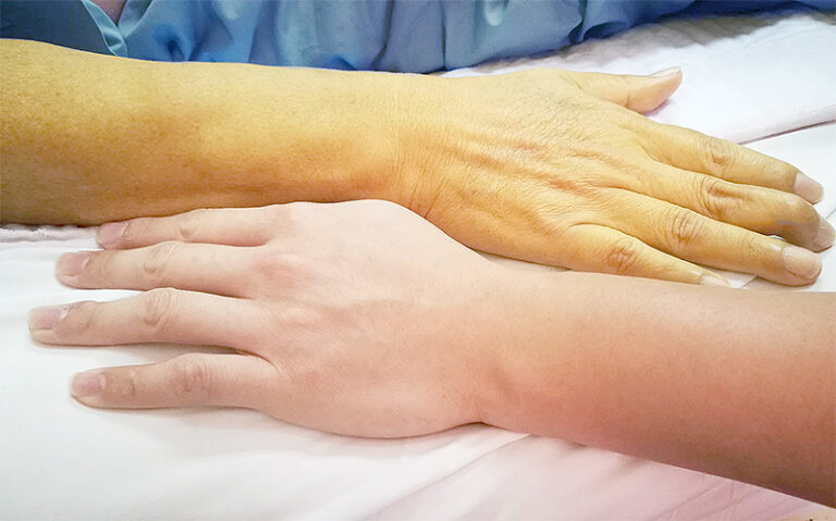 Liver Cancer Risk Factors, Symptoms, and Prevention | Saint John’s ...