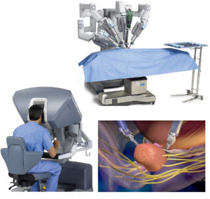 Prostate Cancer Signs, Symptoms, Risk Factors and Diagnosis | Saint ...