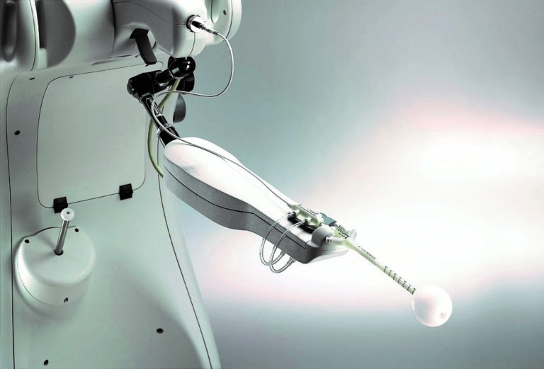 Intraoperative Radiation Therapy for Breast Cancer | Saint John's ...