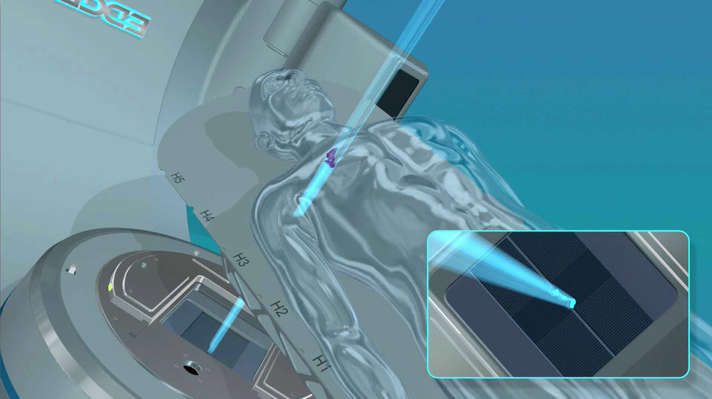 Radiation Oncology - Saint John’s Cancer Institute